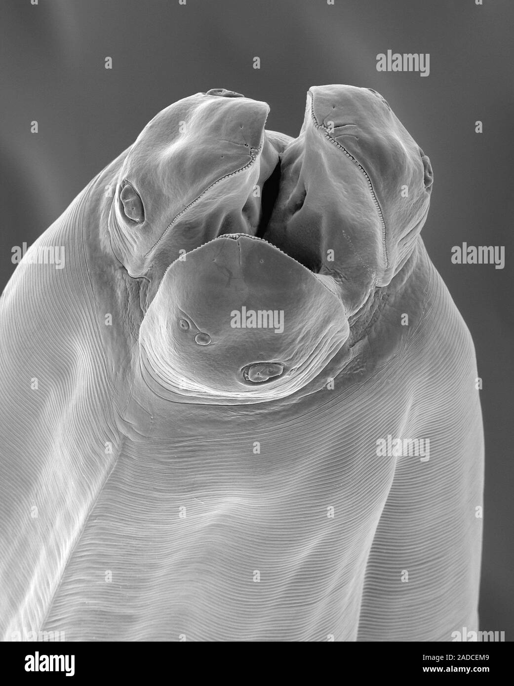 Scanning electron micrograph (SEM) of Dog intestinal roundworm ...