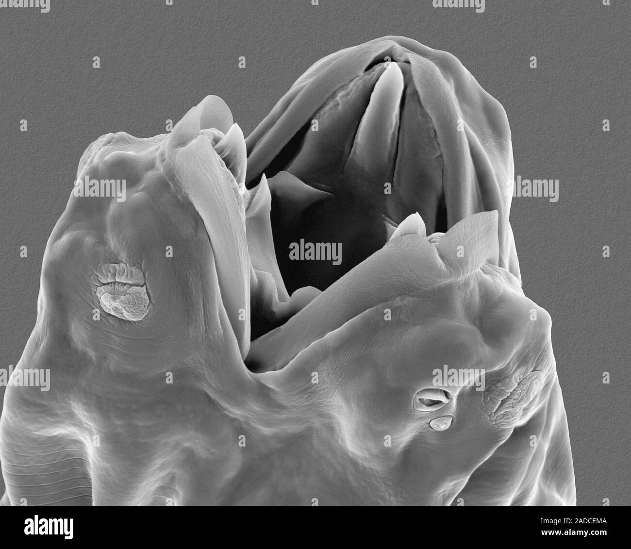 Scanning electron micrograph (SEM) of Poultry roundworm (Heterakis ...