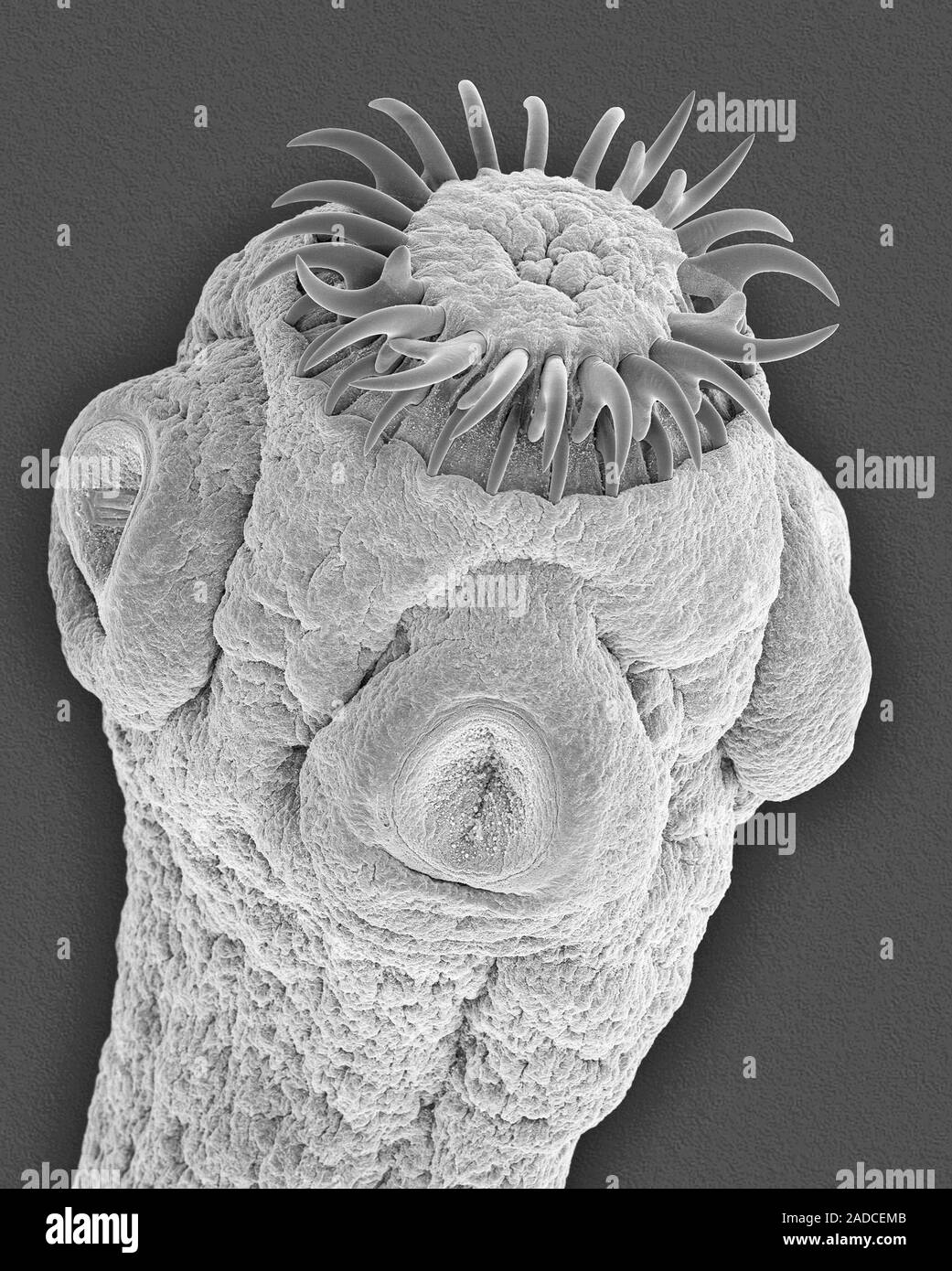 Taenia Taeniaeformis Egg