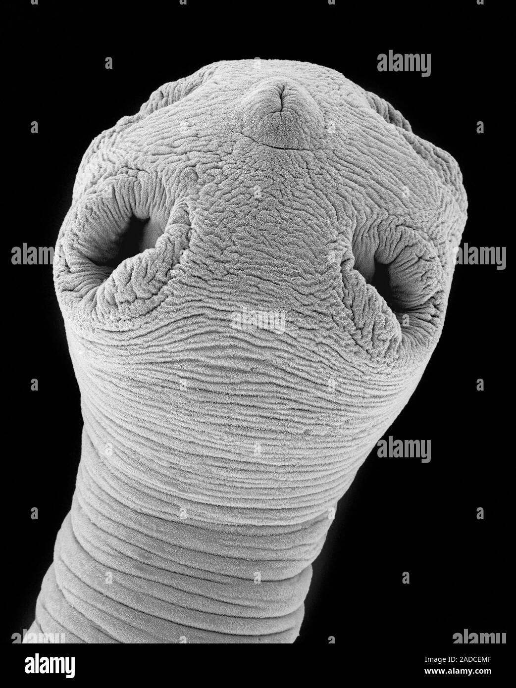 Scanning electron micrograph (SEM) of Dog tapeworm scolex (Dipylidium ...