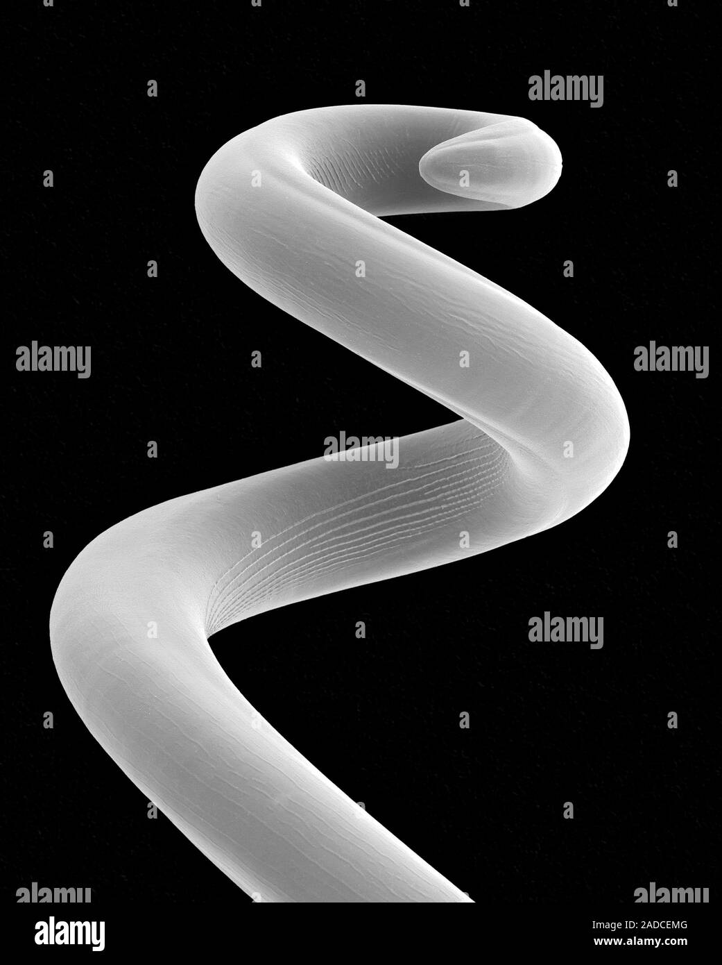 Scanning electron micrograph (SEM) of Dog heartworm (Dirofilaria ...