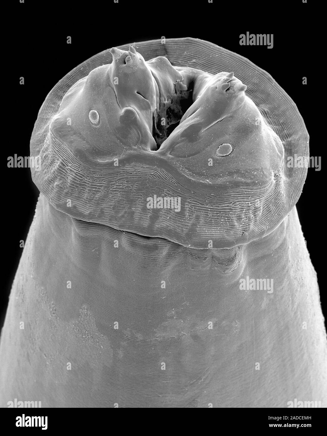 Scanning electron micrograph (SEM) of raccoon intestinal roundworm ...