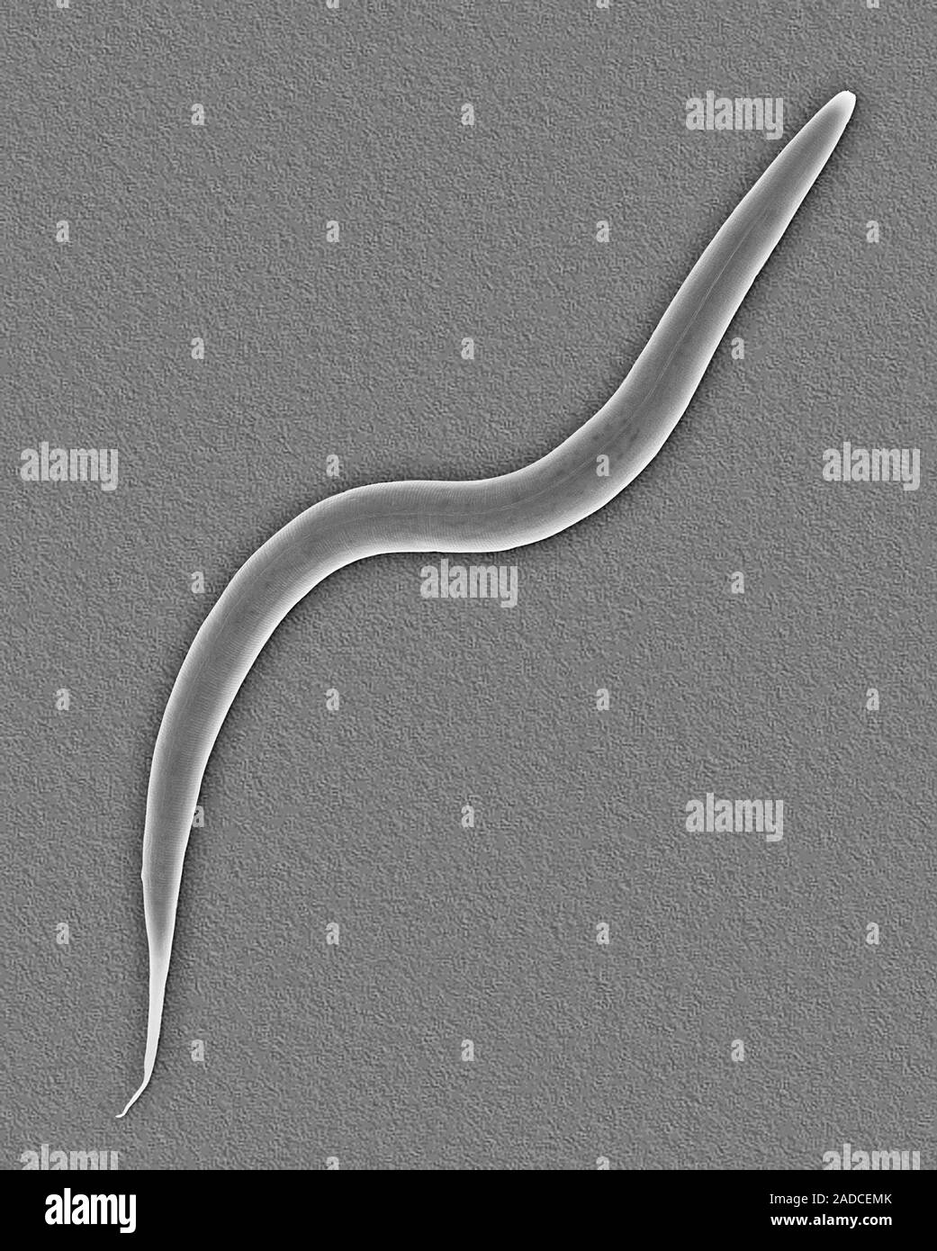 Scanning electron micrograph (SEM) of Free-living soil nematode ...