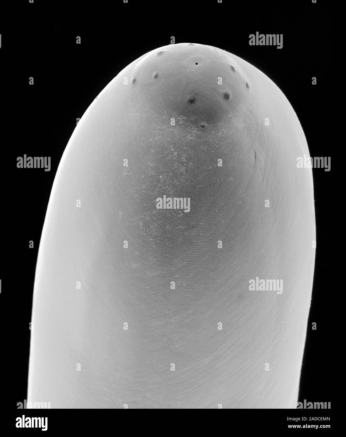 Scanning electron micrograph (SEM) of Dog heartworm anterior stomodeum ...