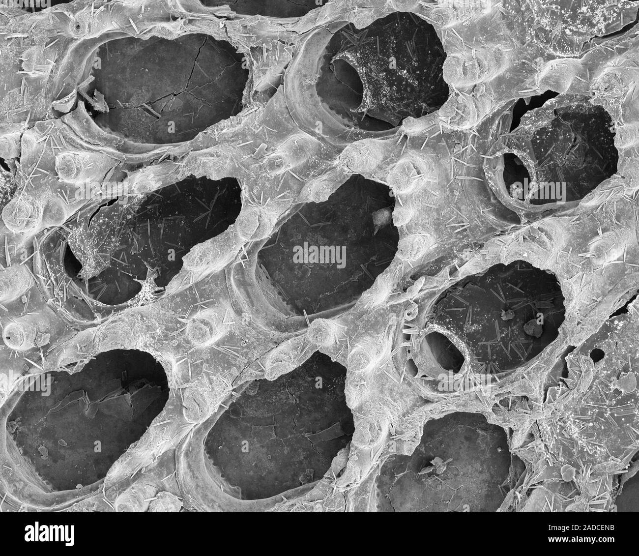 Scanning electron micrograph (SEM) of Bryozoan, lophophorate animals ...