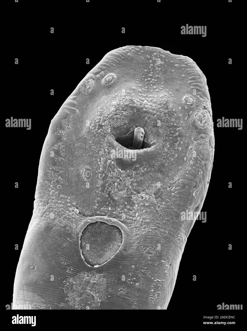 Scanning electron micrograph (SEM) of Dog blood fluke, a trematode ...