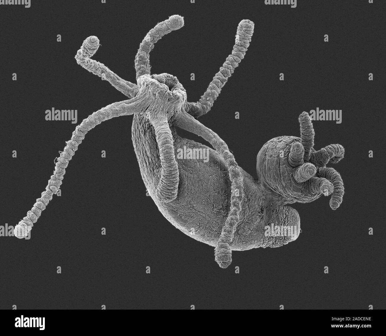 Scanning electron micrograph (SEM) of Freshwater cnidarian (Hydra sp ...