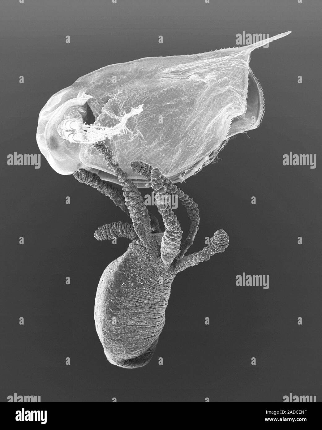 Scanning electron micrograph (SEM) of Freshwater cnidarian (Hydra sp ...
