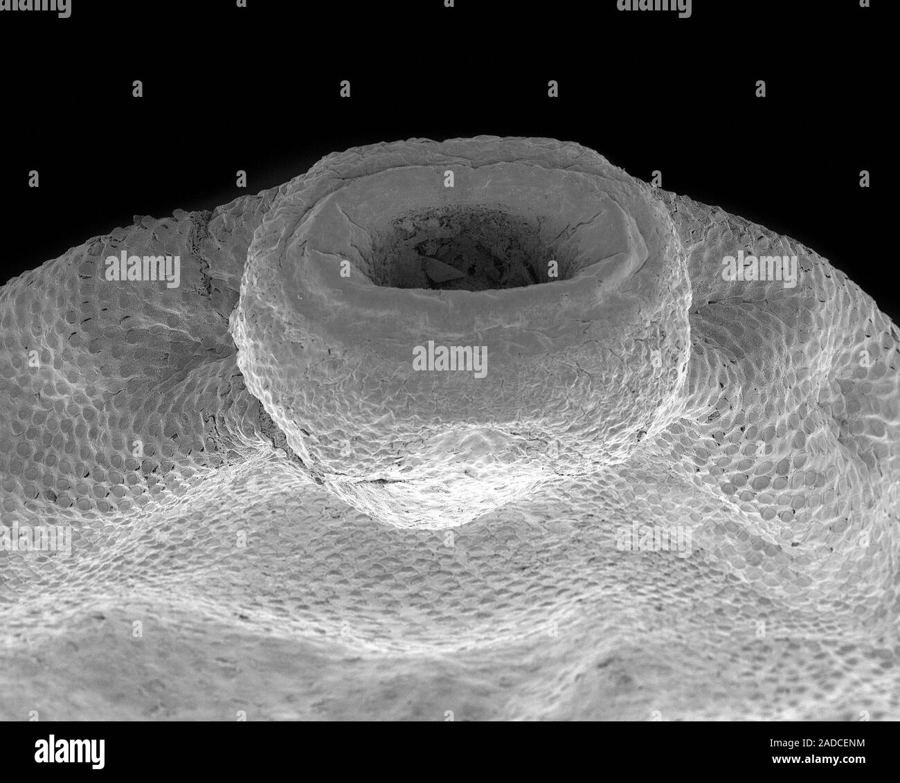 Scanning electron micrograph (SEM) of Liver fluke, a trematode liver ...