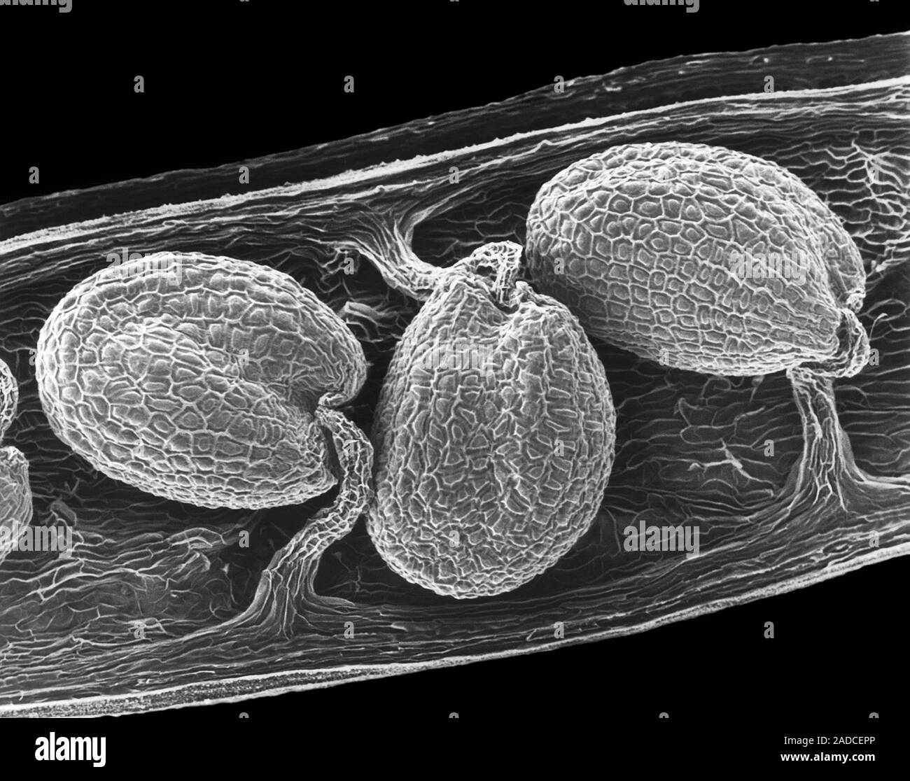 Seed pod with seeds (thale cress; Arabidopsis thaliana), scanning ...