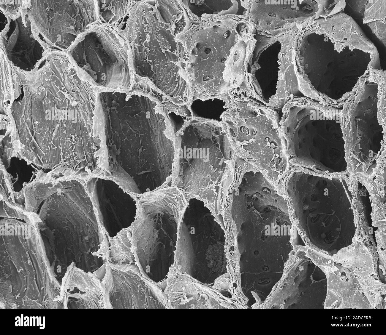 Plant leaf parenchyma cellulose walls (Ohia Lehua leaf; Metrosideros ...