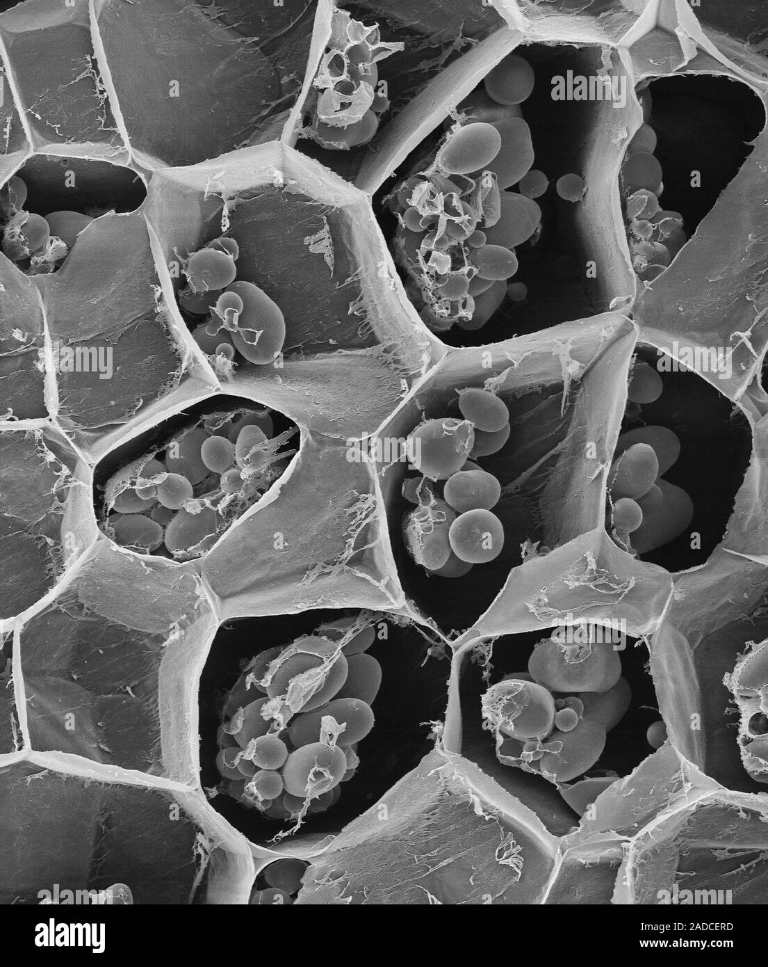 Starch Grains In Raw Potato Cells Scanning Electron Micrograph Sem A Slice Through A Raw