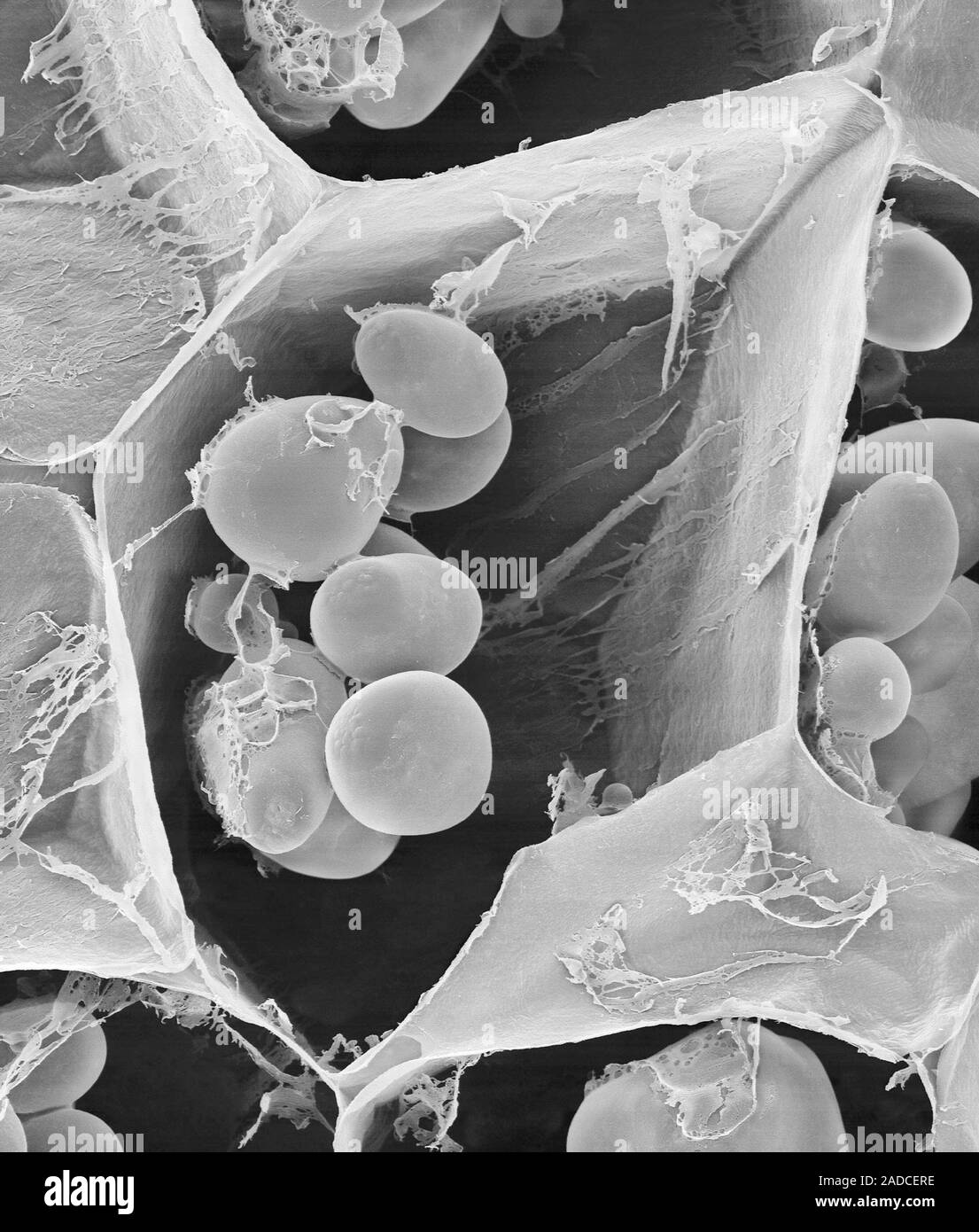 Starch grains in raw potato cells, scanning electron micrograph (SEM ...