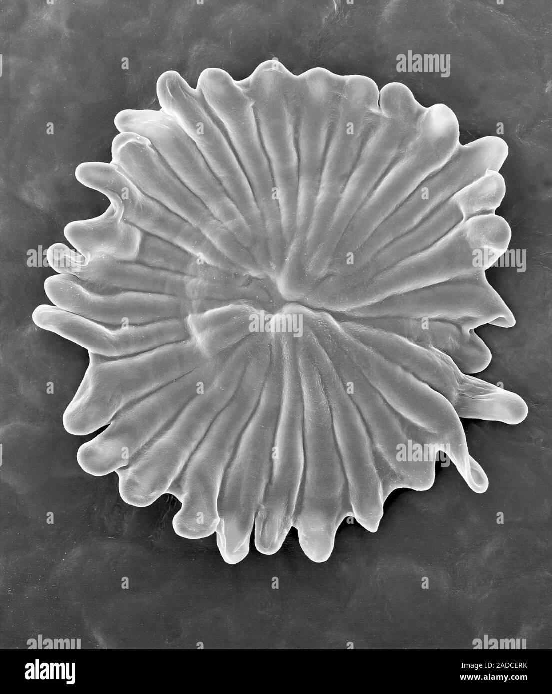 Olive tree leaf trichome (Olea europaea), scanning electron micrograph ...