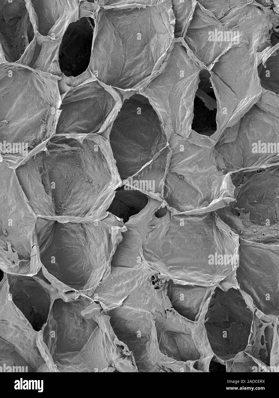 Green bean inner bean pod parenchyma cells (Phaseolus vulgaris; Blue ...