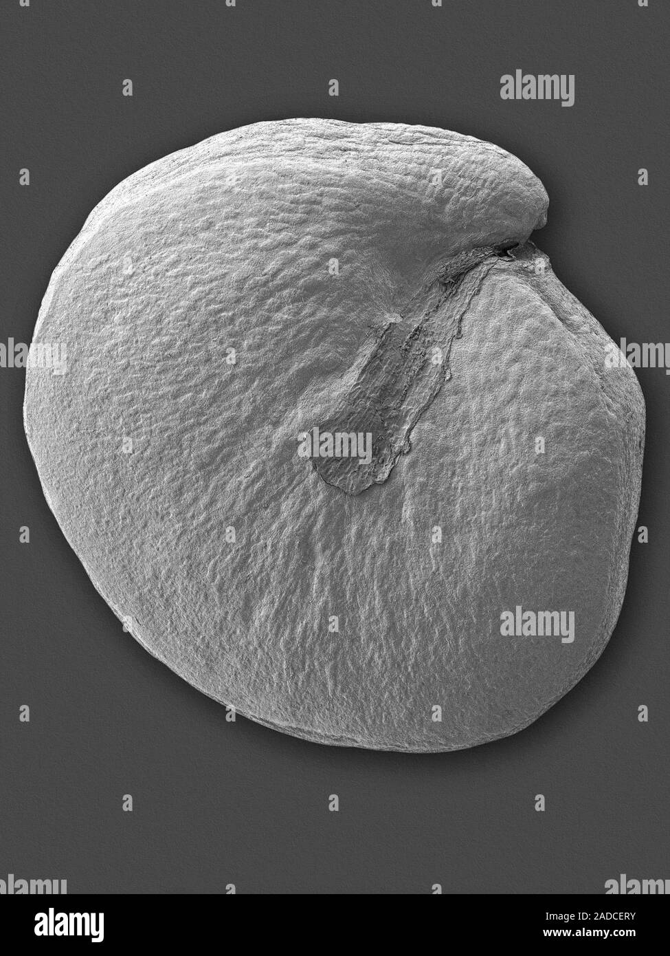 Quinoa seed (Chenopodium quinoa), scanning electron micrograph (SEM ...