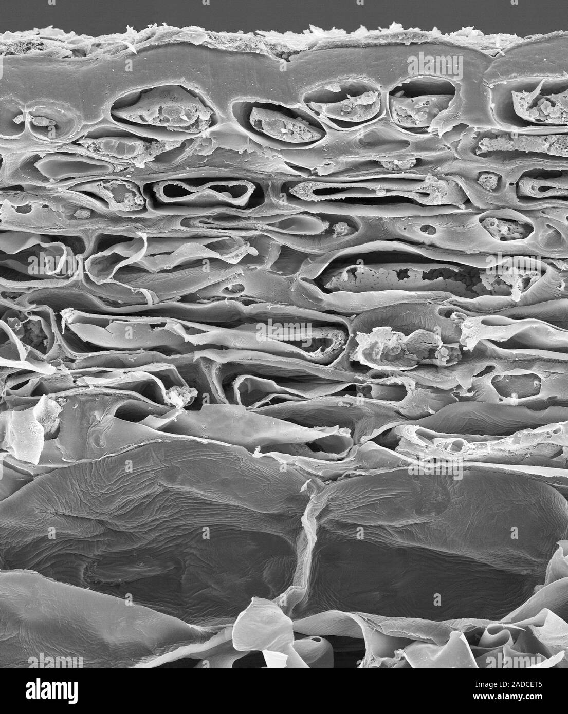 Apple fruit section, skin to parenchyma cells (Malus domestica ...