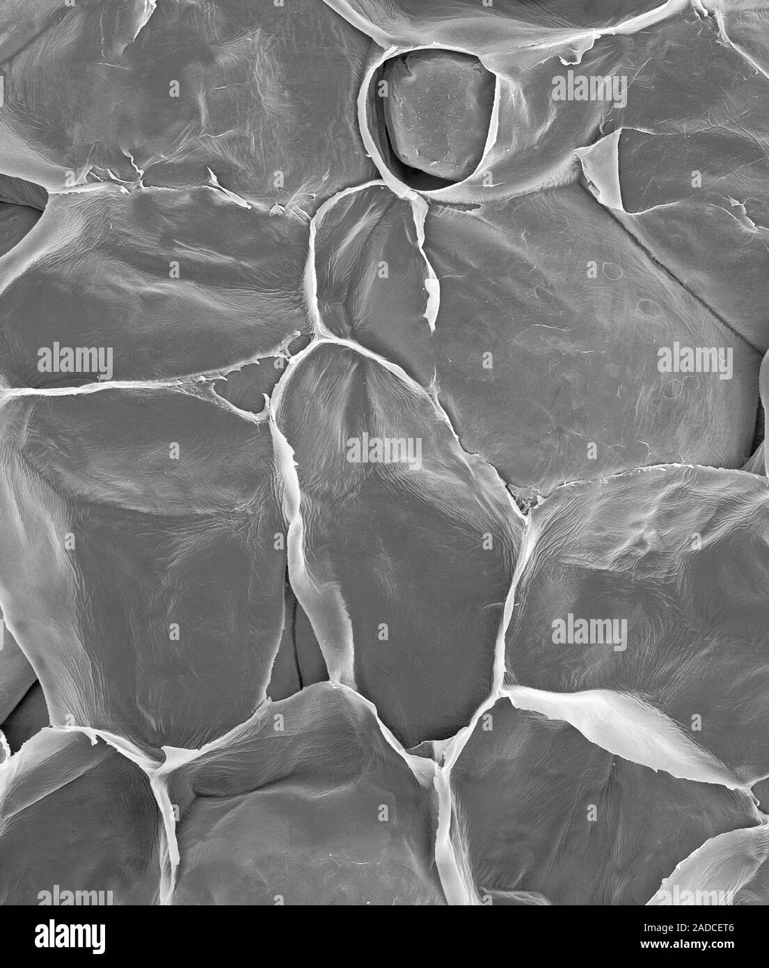 Apple fruit parenchyma cells (Malus domestica), scanning electron ...