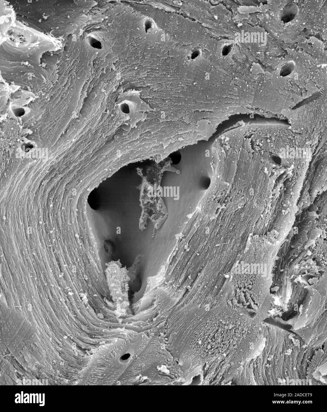 Pear fruit (Pyrus sp.) sclerenchyma cell, scanning electron micrograph (SEM). Section through a ...
