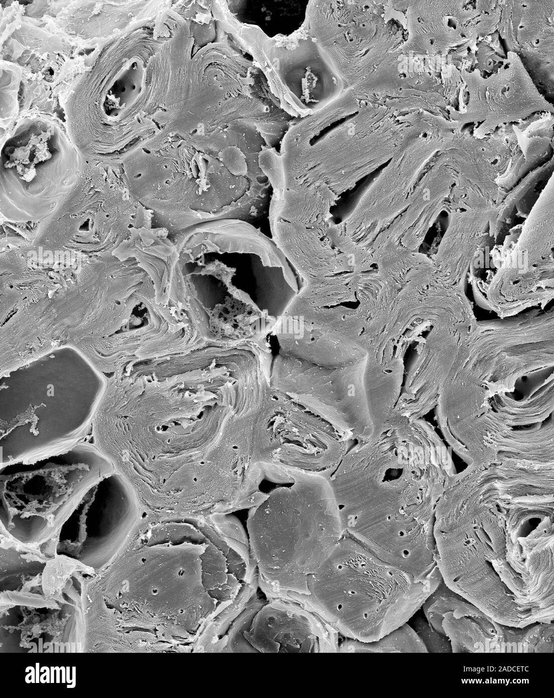 Pear fruit (Pyrus sp.) sclerenchyma cells, scanning electron micrograph (SEM). Shown here is a ...