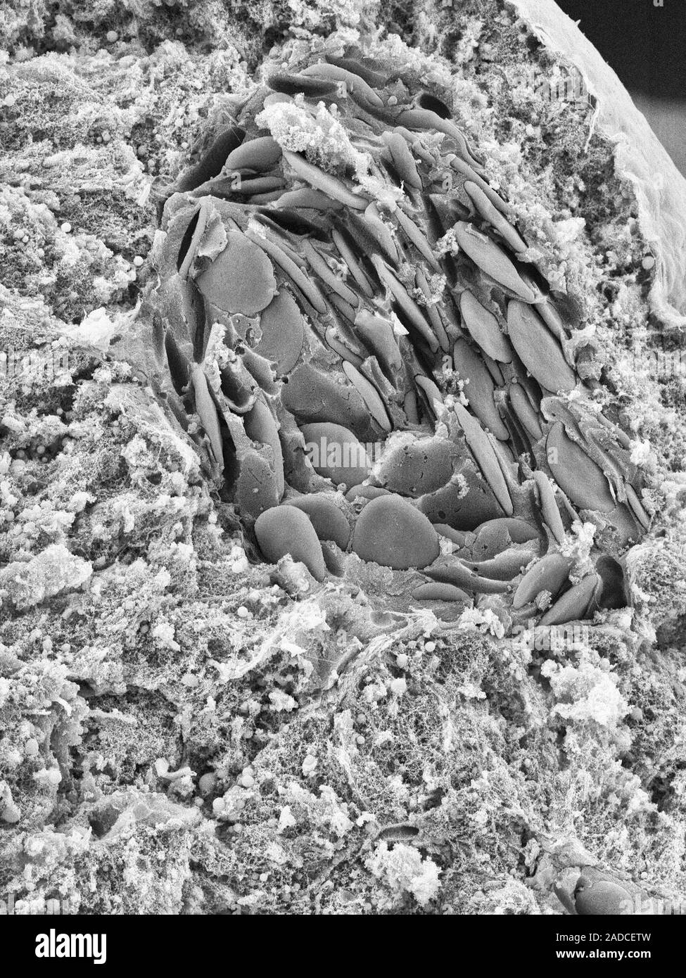 Scanning electron micrograph (SEM) Frog blood in liver blood vessel ...