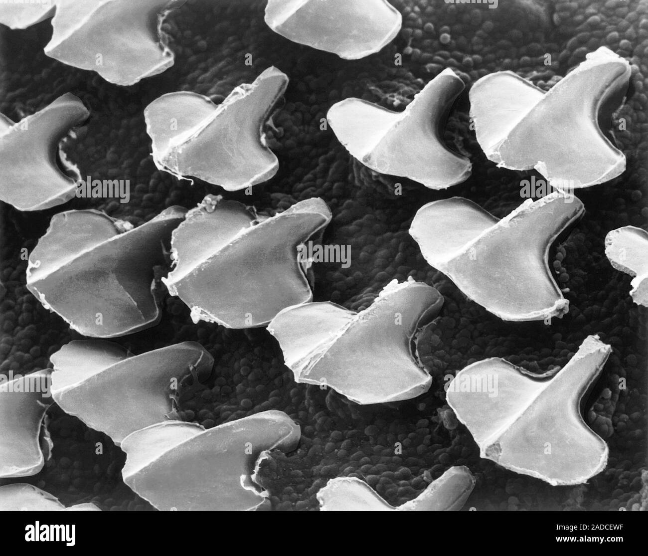 Scanning electron micrograph (SEM) Dogfish (shark) denticles on skin ...