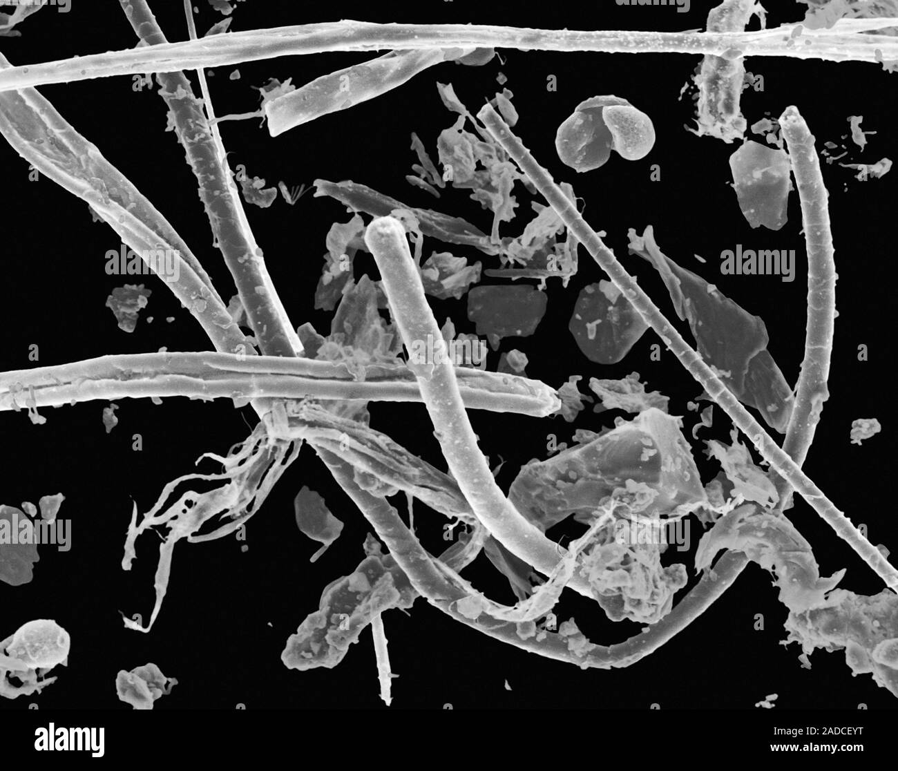 Scanning electron micrograph (SEM) of House dust. Components of dust ...