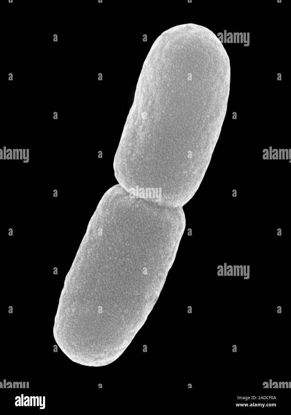 Scanning electron micrograph (SEM) of Pseudomonas aeruginosa bacteria ...