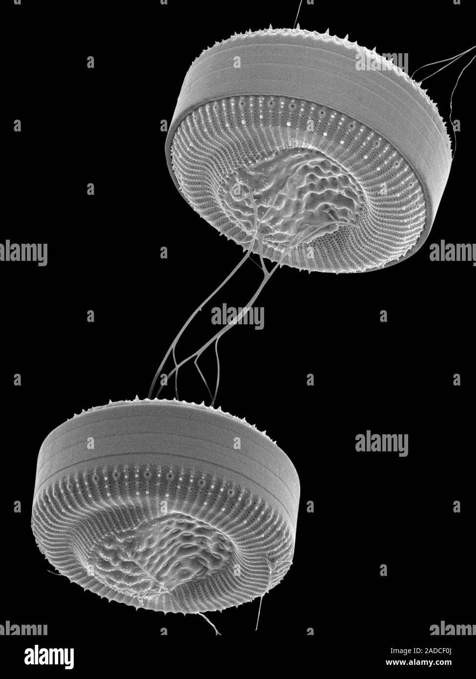 Scanning electron micrograph (SEM) of a diatom (Cyclotella sp ...