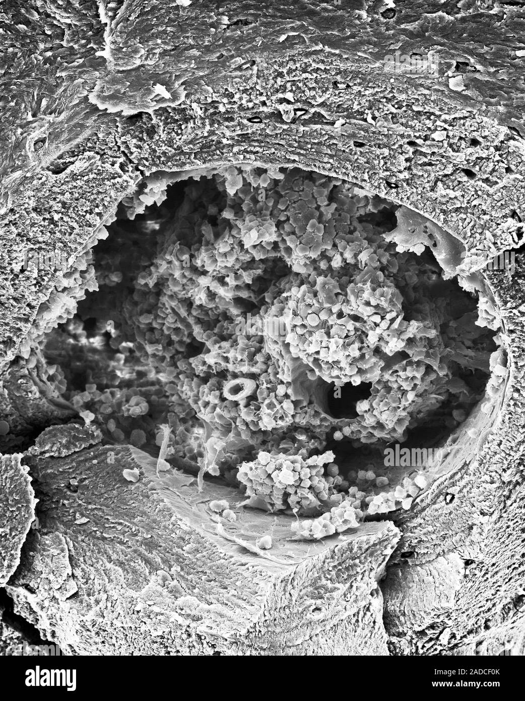 Compact bone and bone marrow cavity (lacuna), scanning electron ...