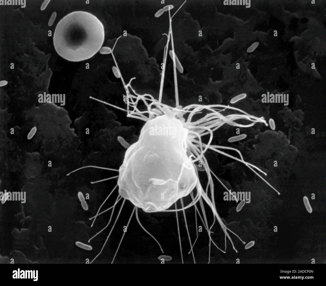 Alveolar macrophage phagocytosis of E. coli, scanning electron ...