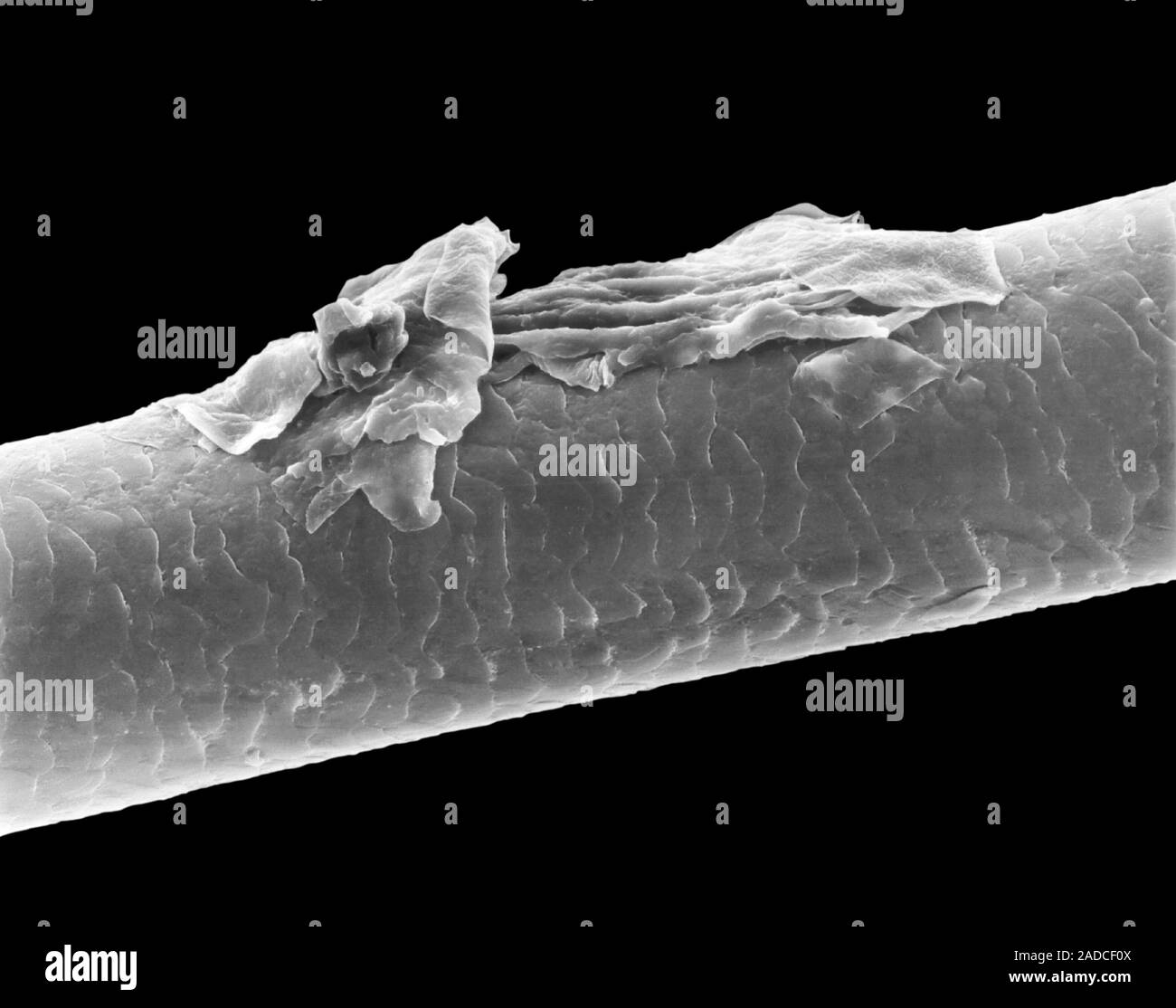 Human hair with dandruff, scanning electron micrograph (SEM). The outer ...