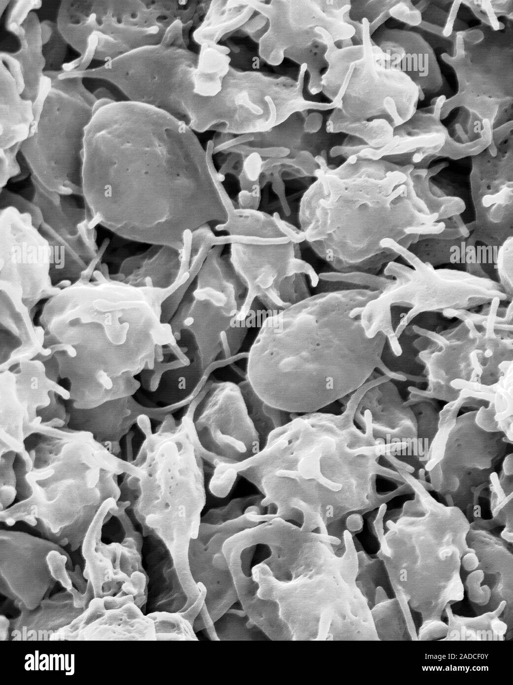Activated platelets with channels of the open canalicular system, scanning electron micrograph ...