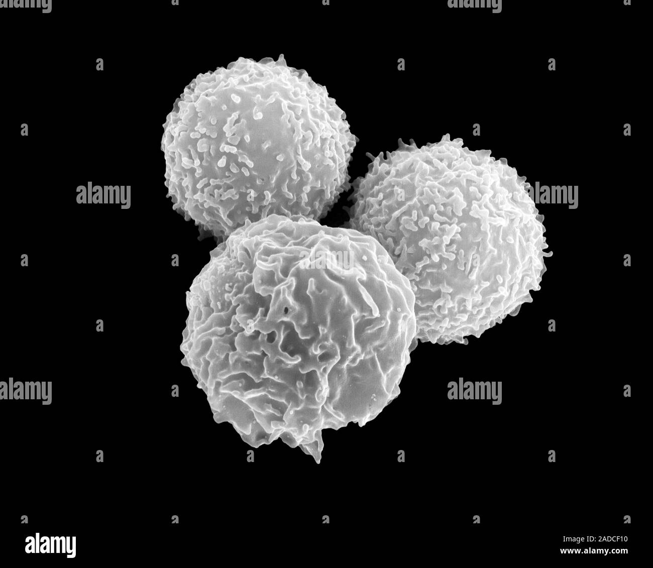 T lymphocytes (pre-T cells) and granulocyte (neutrophil), scanning ...