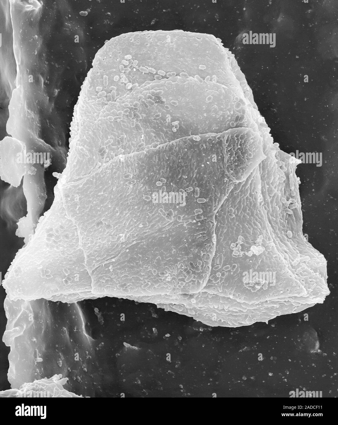 Used wax dental floss with cheek cells and bacteria on dental floss ...