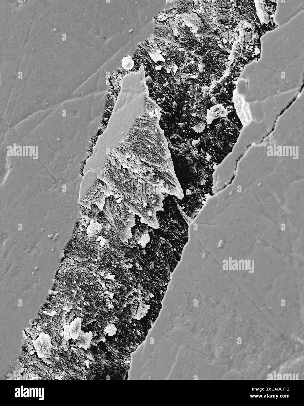 Human tooth fractured enamel, scanning electron micrograph (SEM ...