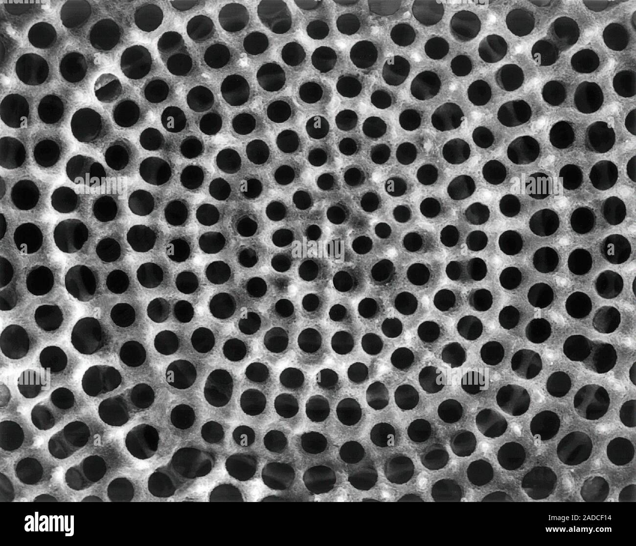 Radiolarian test (marine), scanning electron micrograph (SEM). The hard ...