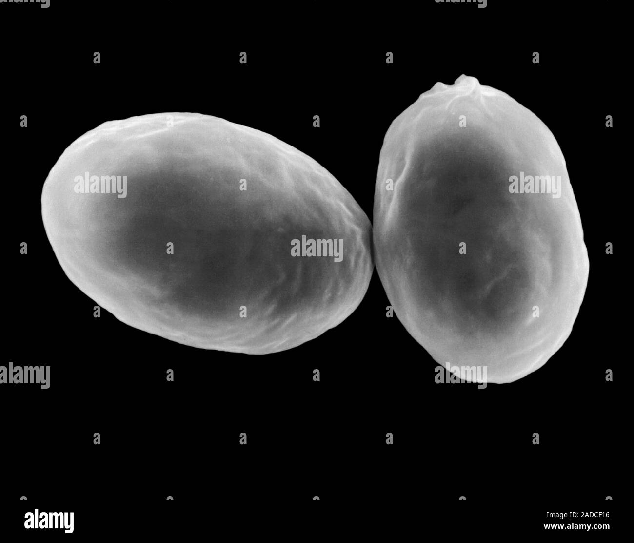 Giardia lamblia, a protozoan (cyst stage) found in water contaminated ...