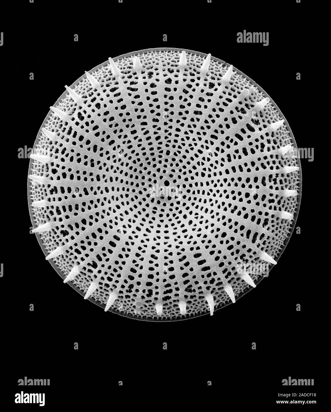 Scanning electron micrograph (SEM) of centric fossil diatom frustule ...