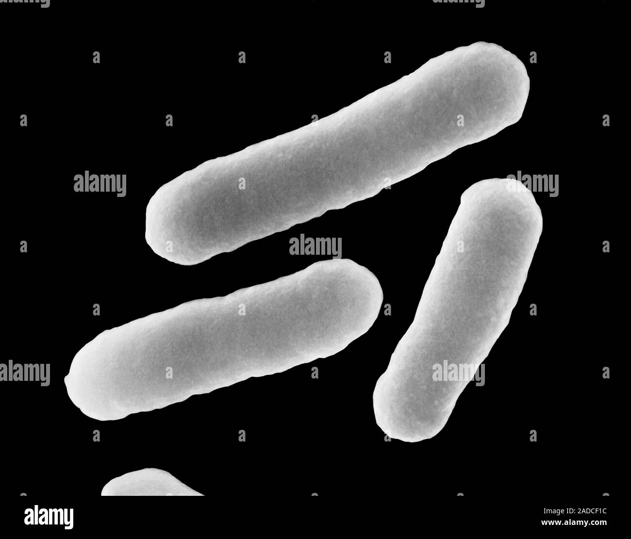 Scanning electron micrograph (SEM) of E. coli (Escherichia coli ...