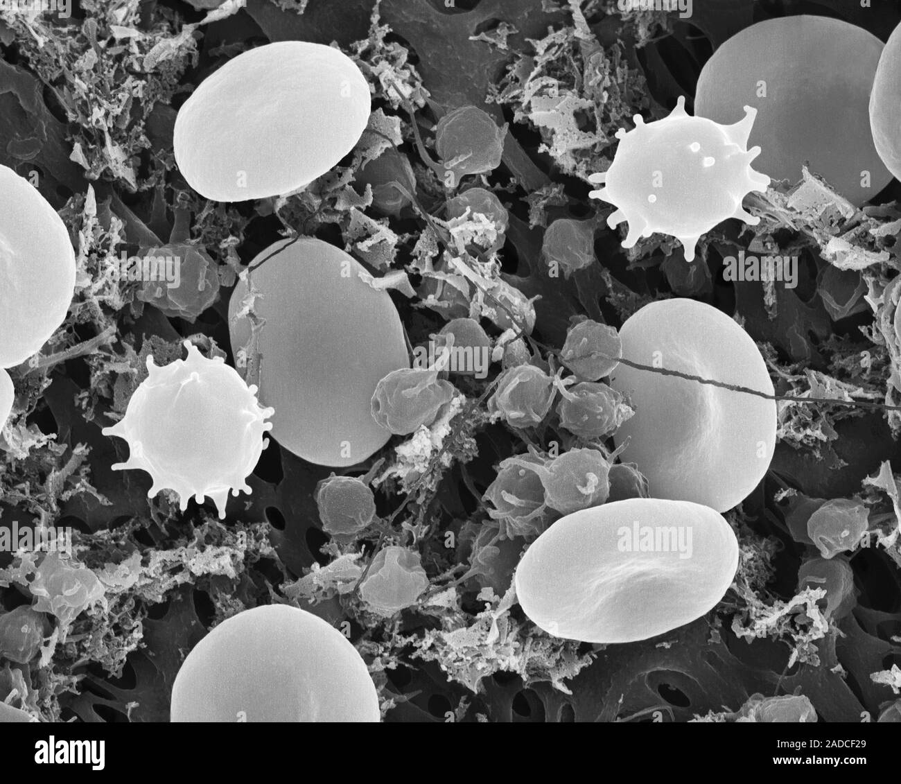 Human red blood cells, monocytes (white blood cells), activated ...