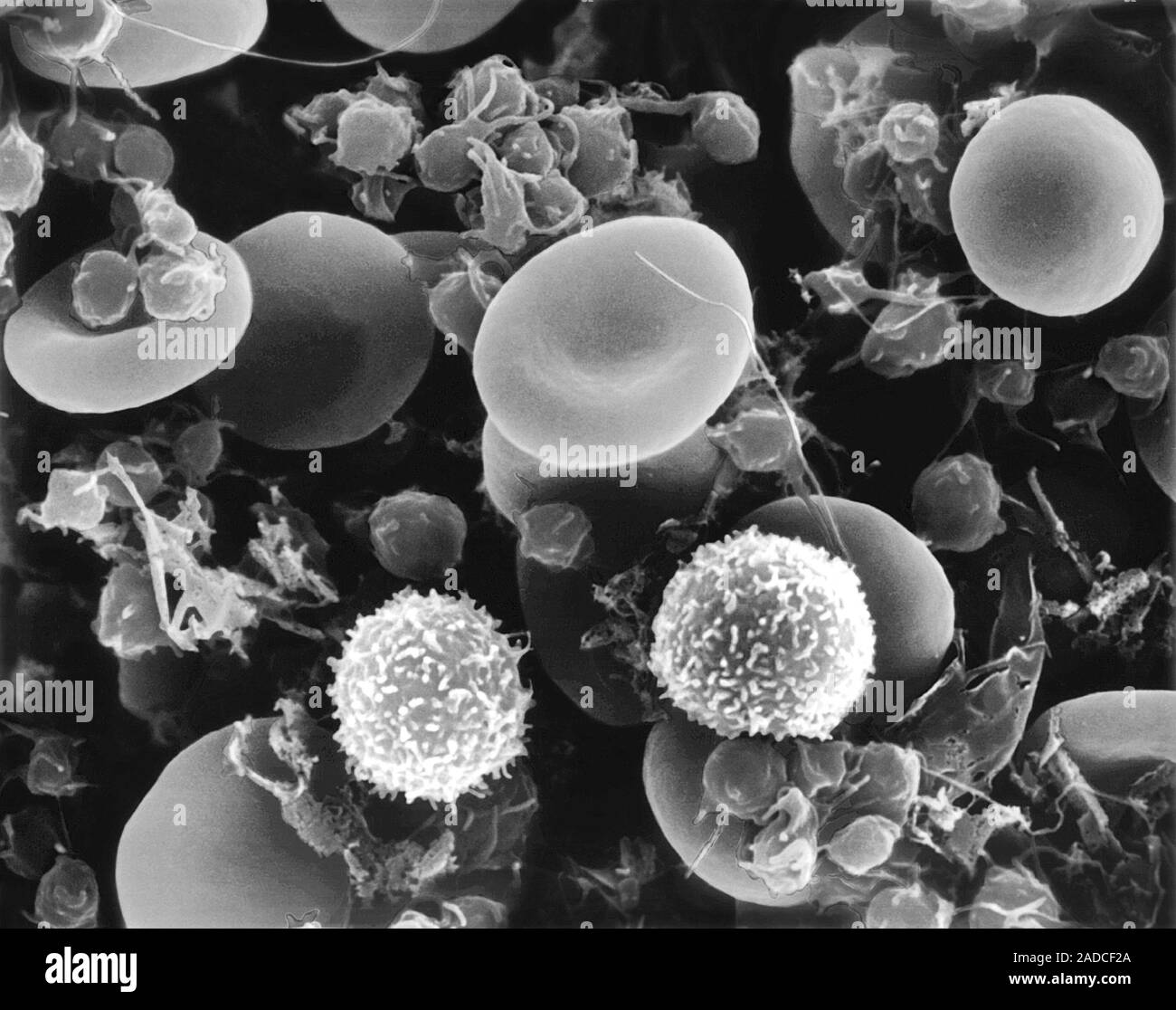 Human red blood cells, two T lymphocytes and platelets, scanning ...