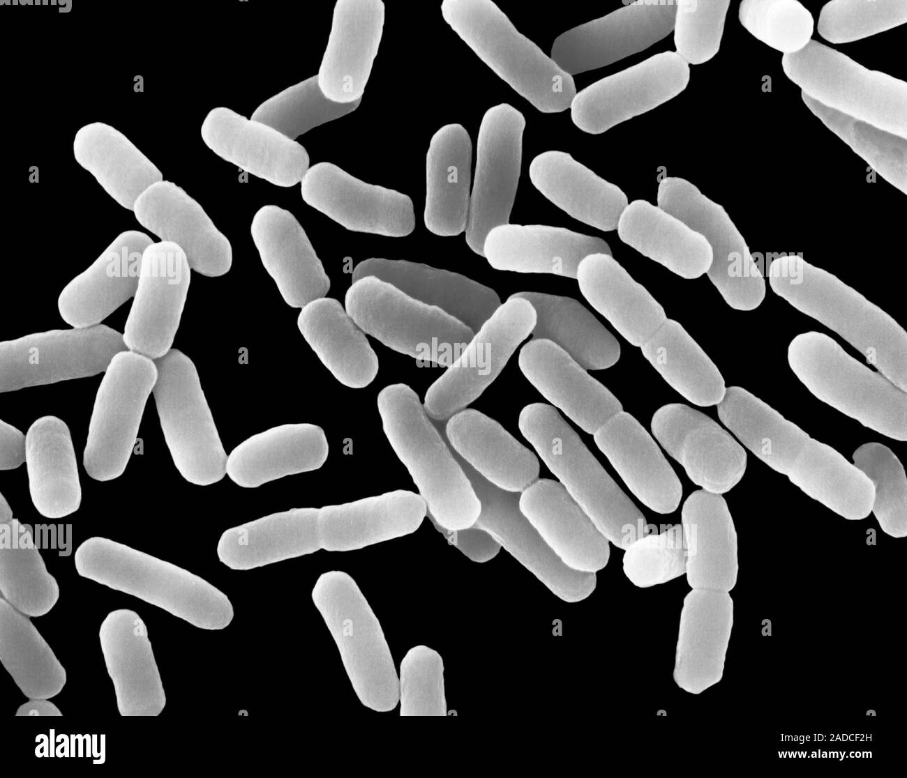 Scanning electron micrograph (SEM) of Escherichia coli is a Gram ...