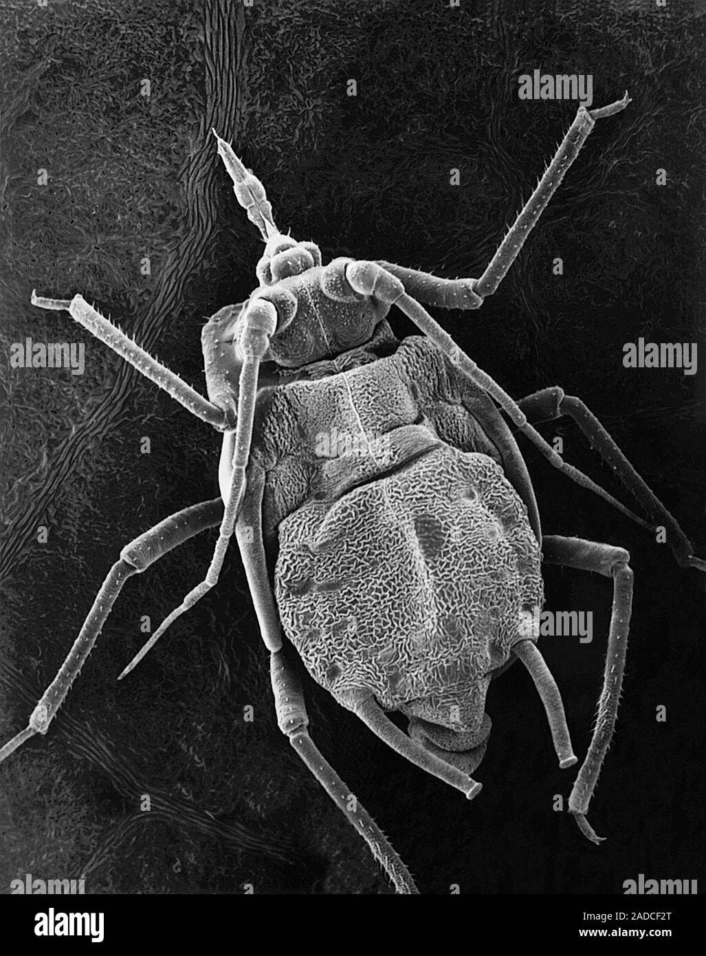 Scanning electron micrograph (SEM) of Pea aphid (Acyrthosiphon pisum ...