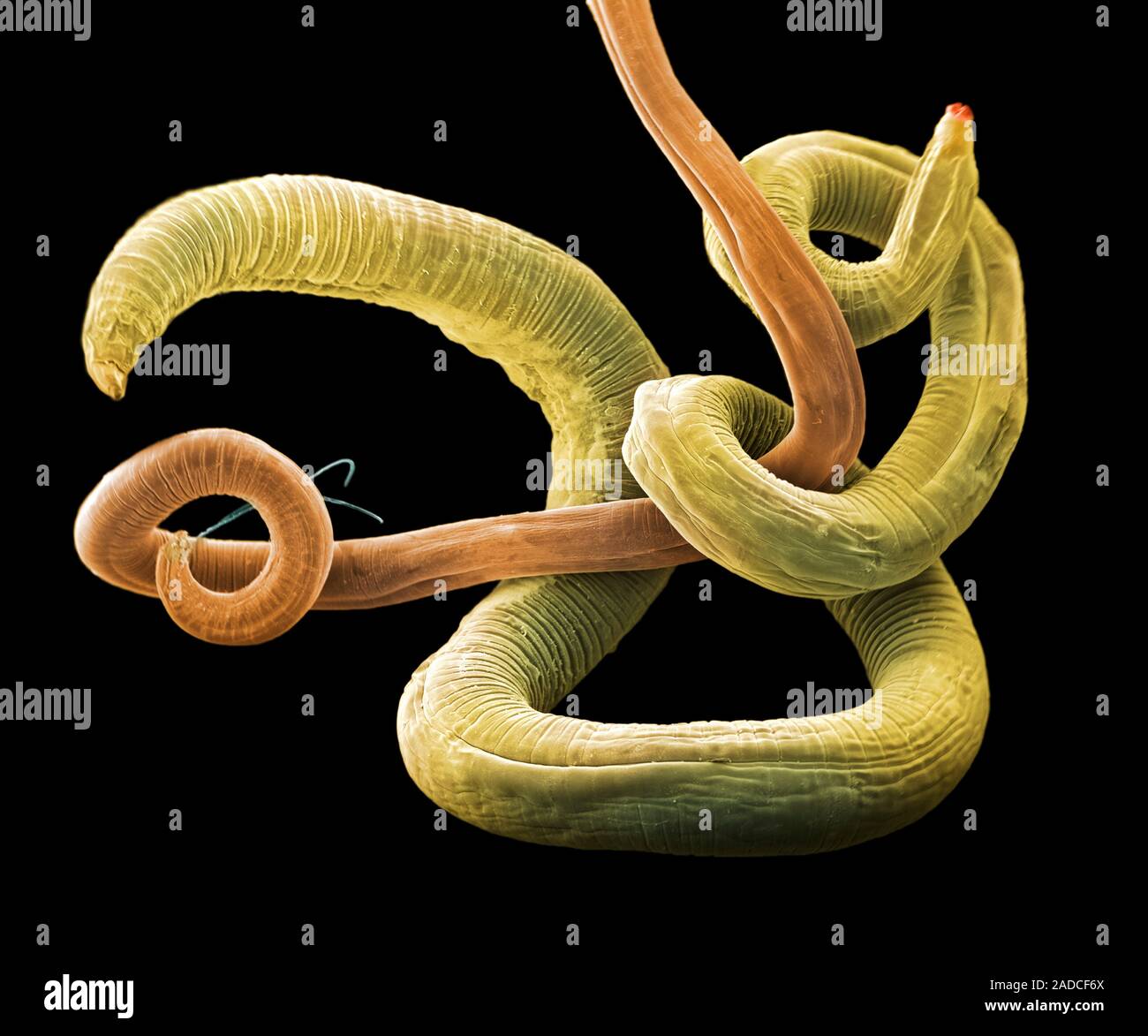 Coloured scanning electron micrograph (SEM) of a female and male ...