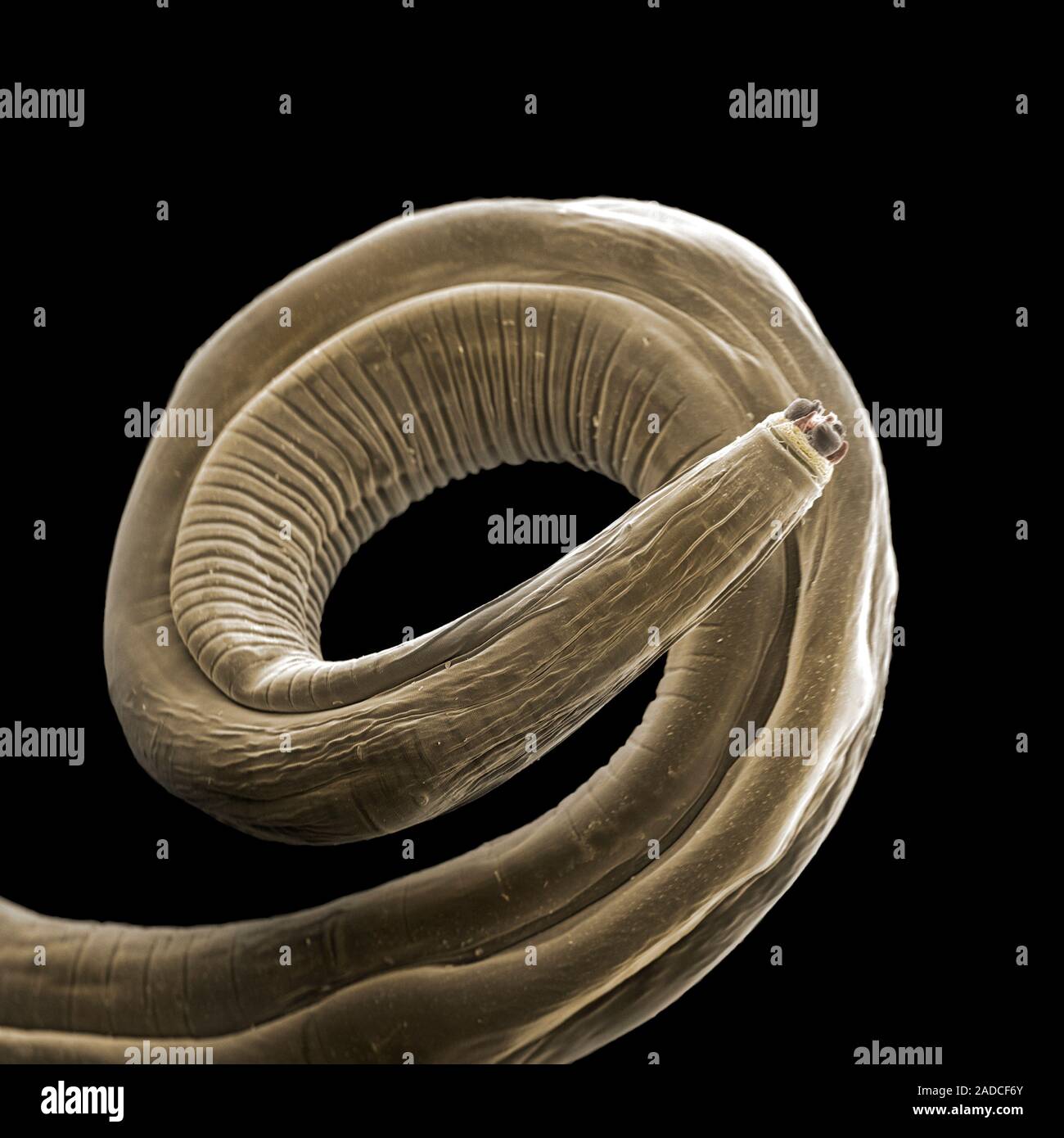 Coloured scanning electron micrograph (SEM) of the anterior part of a ...