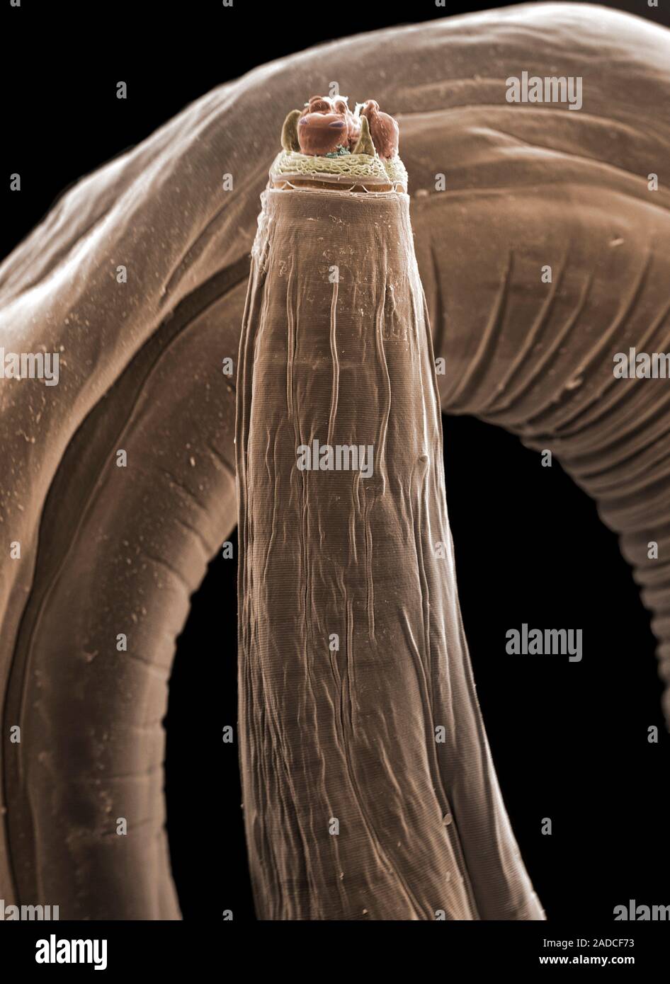 Coloured scanning electron micrograph (SEM) of the anterior part of a ...