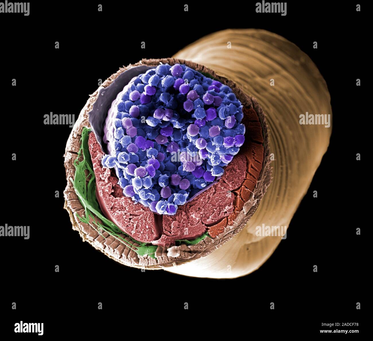 Coloured scanning electron micrograph (SEM) of roundworm (Contracaecum ...