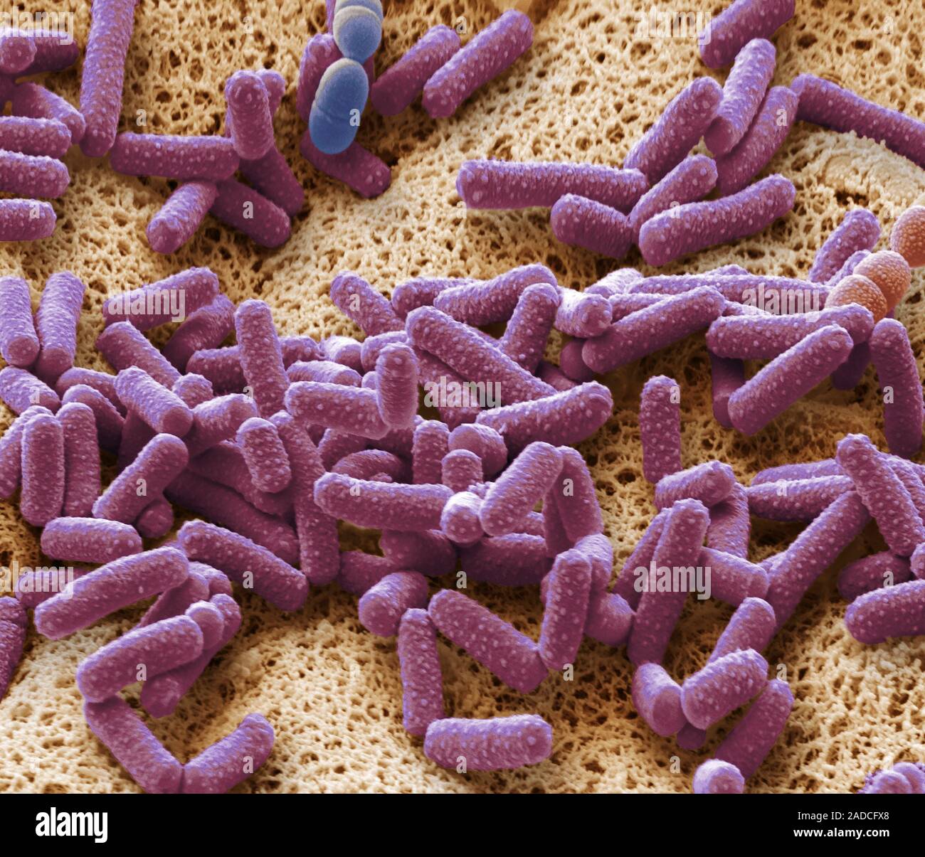Pasteurella multocida bacteria. Coloured scanning electron micrograph (SEM) of Pasteurella ...