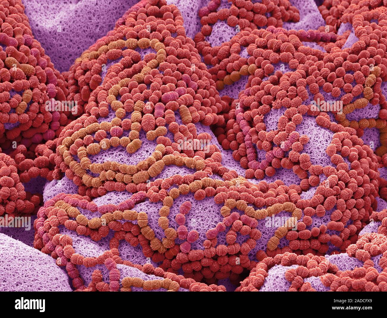 Tooth bacteria. Coloured scanning electron micrograph (SEM) of bacteria ...